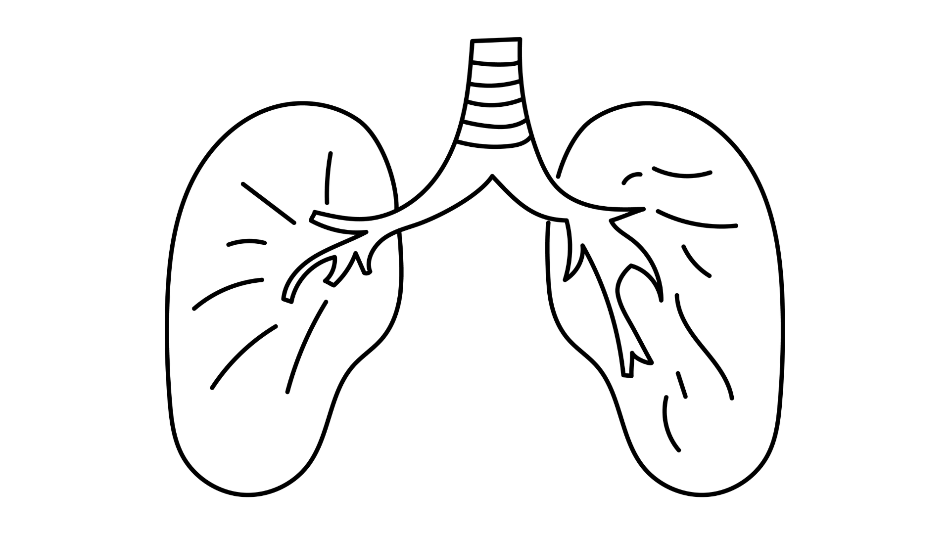 Is g2211 Only for Medicare? 2025